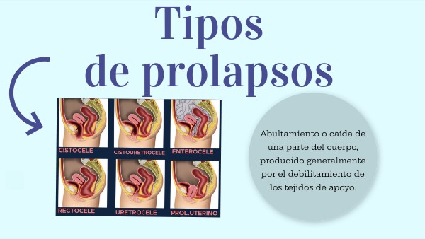 Tipos de prolapsos | Genially