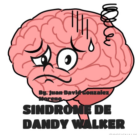 Síndrome de Dandy Walker | Genially