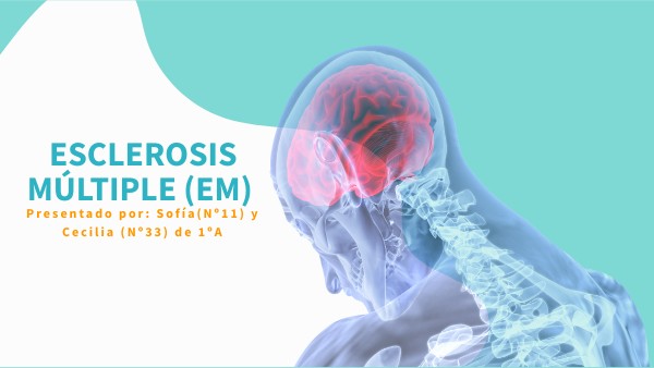 Esclerosis múltiple | Genially