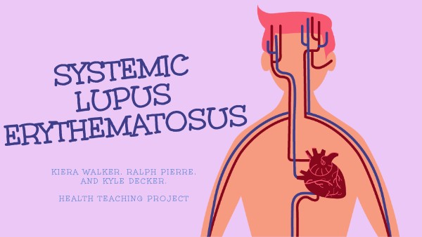LUPUS PRESENTATION | Genially