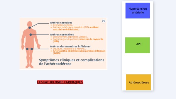 Les pathologies cardiaques | Genially