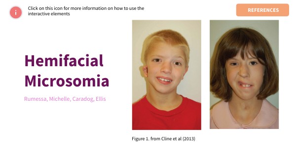 Hemifacial Microsomia | Genially