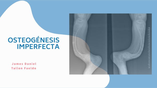 PRESENTACIÓN OSTEOGÉNESIS IMPERFECTA | Genially