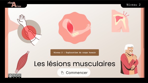 Les lésions musculaires | Genially