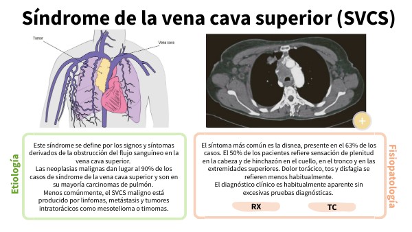 Teleterapia en Síndrome de compresión de la vena cava superior | Genially
