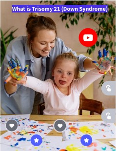 Learning about Down Syndrome