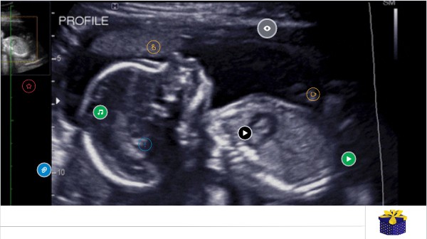 Heredity, Prenatal Development, and Birth