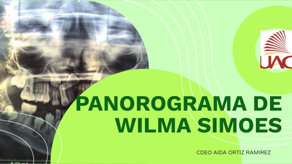PANOROGRAMA DE WILMA SIMOES | Genially