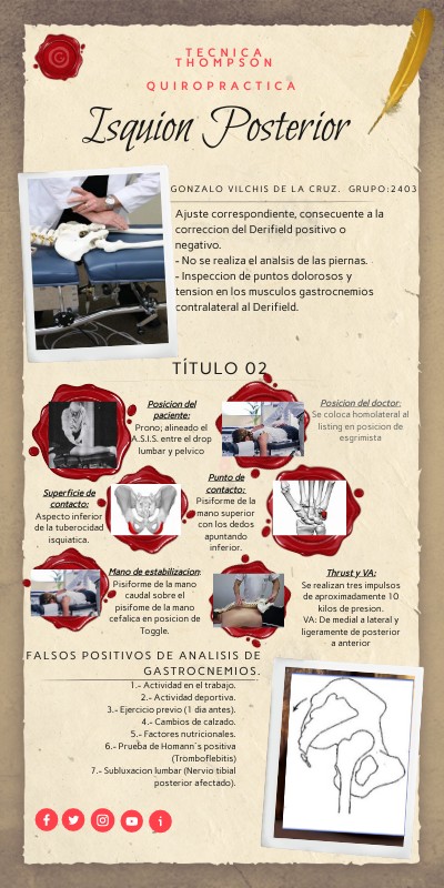 TECNICA THOMPSON ISQUION POSTERIOR | Genially