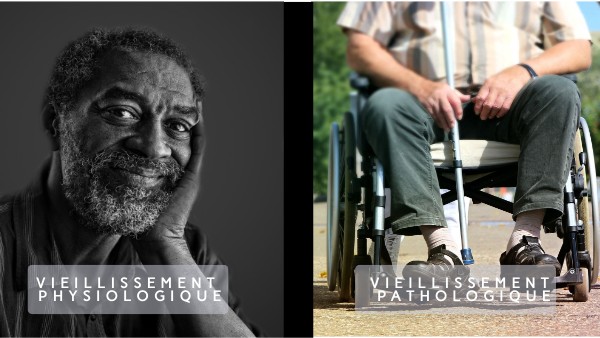 Vieillissement physio/patho | Genially