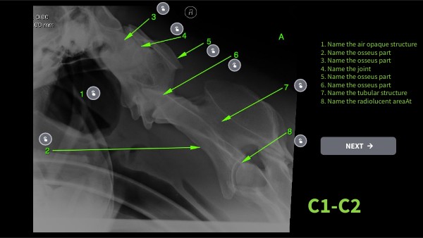 Cervical Spine Radiographs