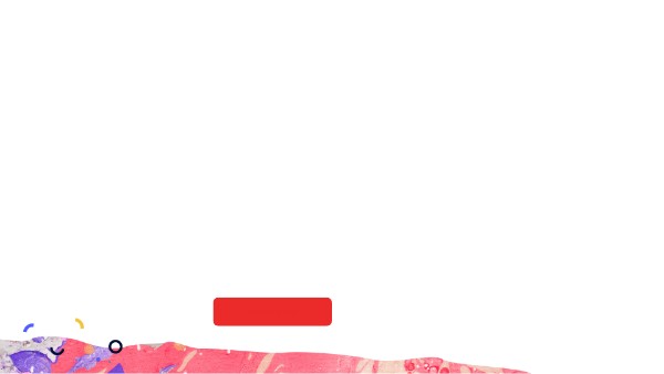 KB 1 P C - What are you doing?