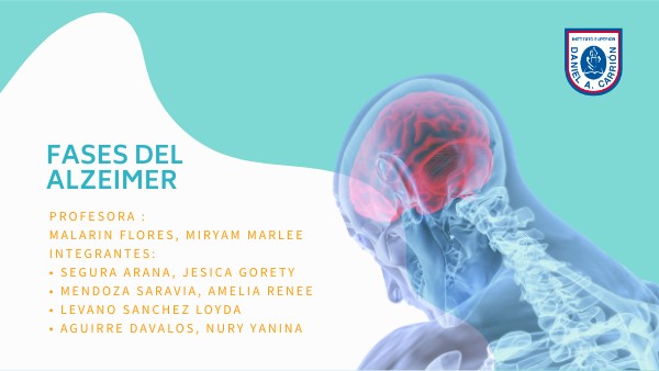 FASES DEL ALZEIMER | Genially