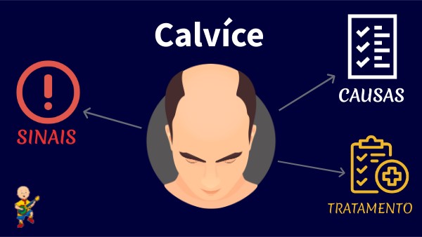 Calvíce