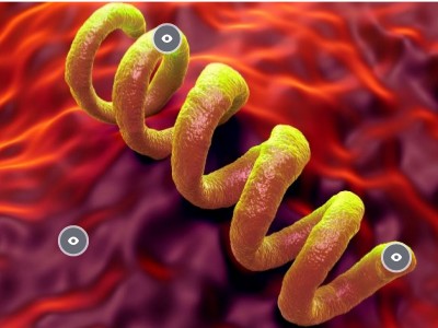 syphilis plaize antoine