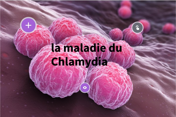 Chlamydia Matilda RL 4C