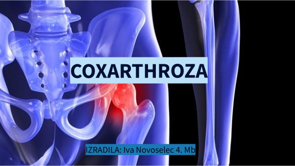 coxarthroza