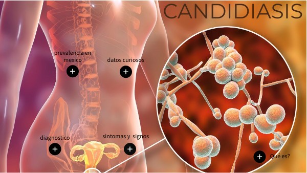 candidiasis | Genially