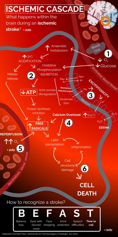 Ischemic cascade - Curso Genially UAM
