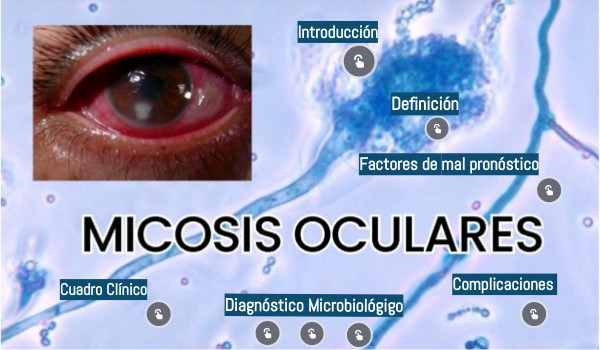 Micosis Oculares | Genially