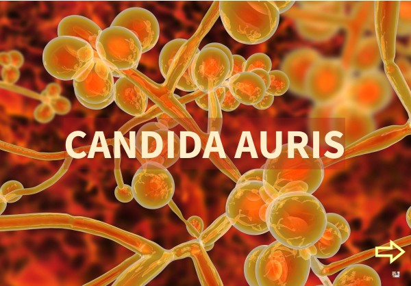 CANDIDA AURIS | Genially