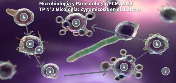 Zygomicosis en diabéticos
