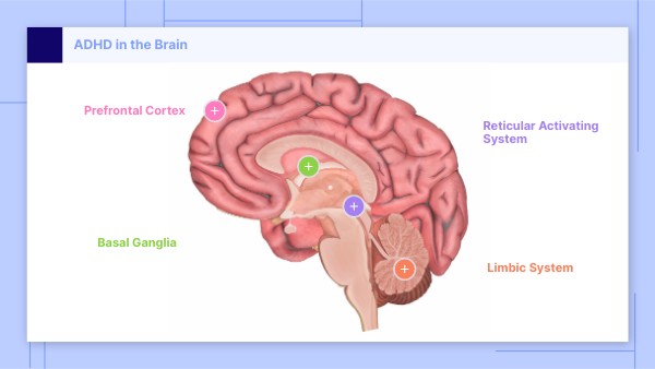 ADHD in the brain | Genially