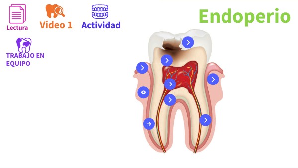 Endoperio | Genially
