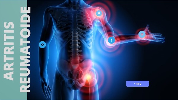 lámina artritis | Genially