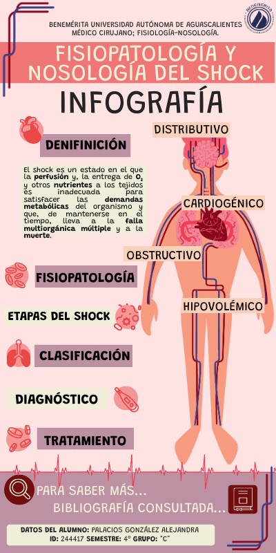 INFOGRAFIA DEL SHOCK | Genially