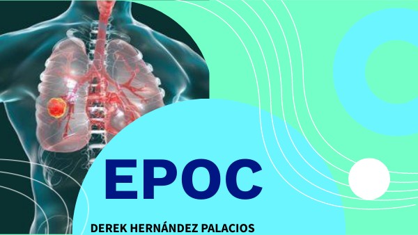 EPOC