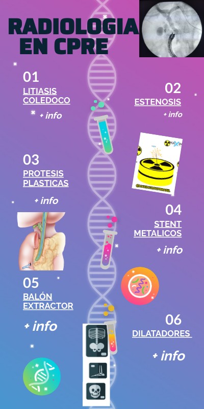 RADIOLOGIA EN CPRE | Genially