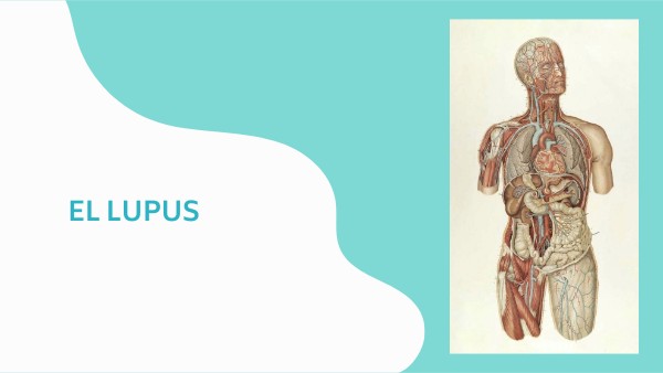 PRESENTACIÓN LUPUS | Genially
