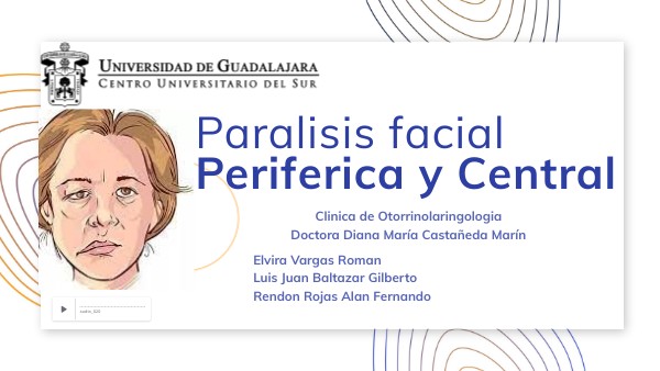 Parálisis facial: Periférica y Central | Genially