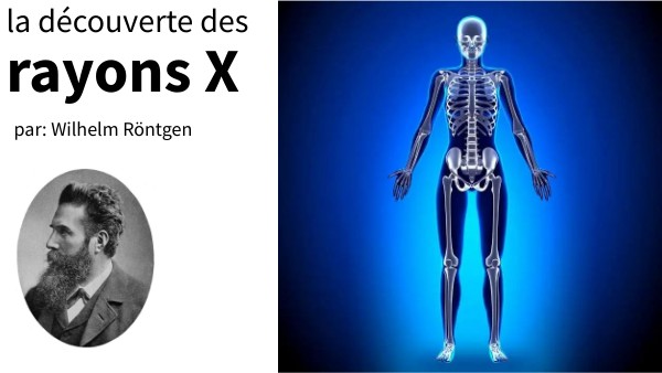 éxposer les rayon X
