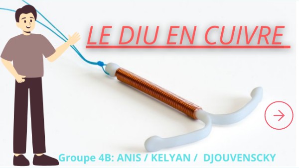 Le DIU avec Cuivre