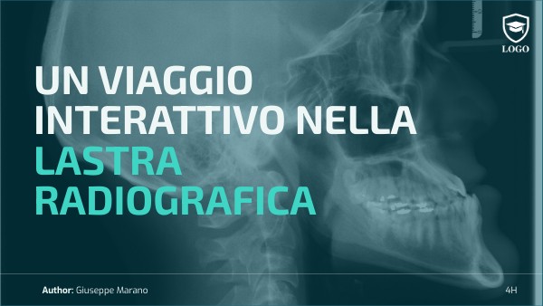 La lastra | Genially