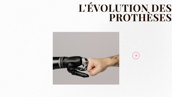 Présentation prothèse inay youssouf