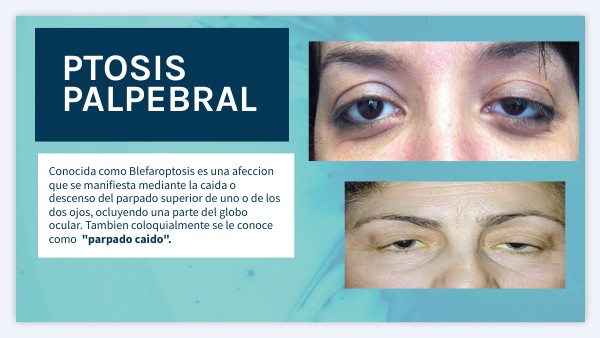 Patologias Oculares.Heidy