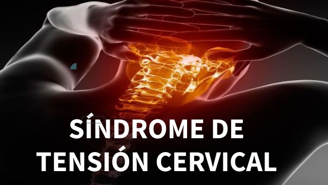 Sx TENSIONAL DEL CUELLO | Genially