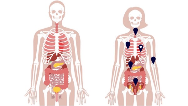 Stress in Your Body Systems Template | Genially
