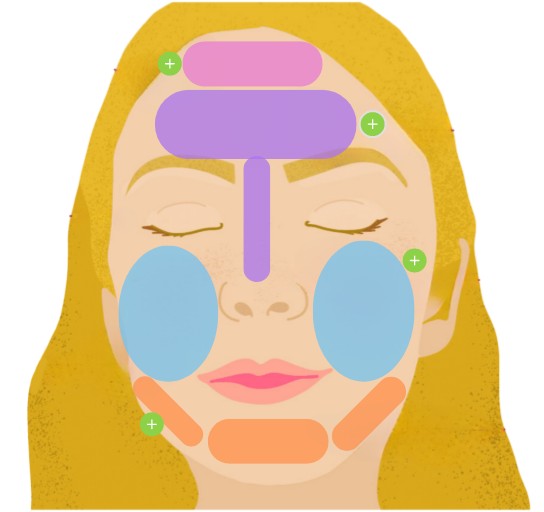 Acne Mapping | Genially