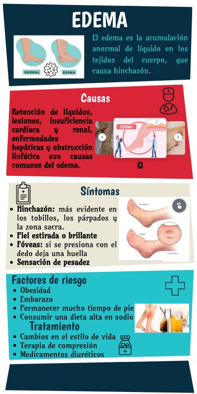 INFO RETRO | Genially